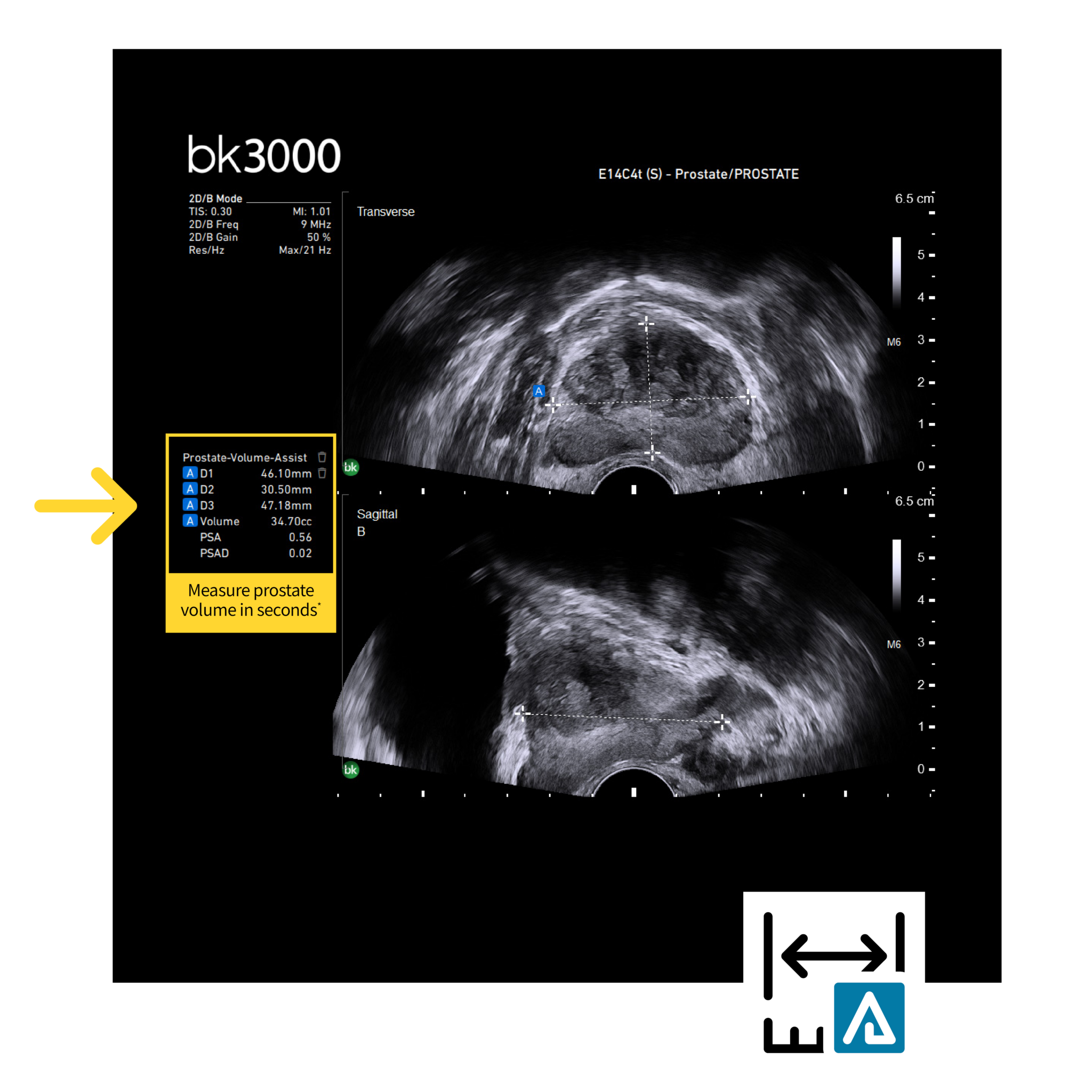 Ultrasound Machines for Prostate Imaging | BK Medical