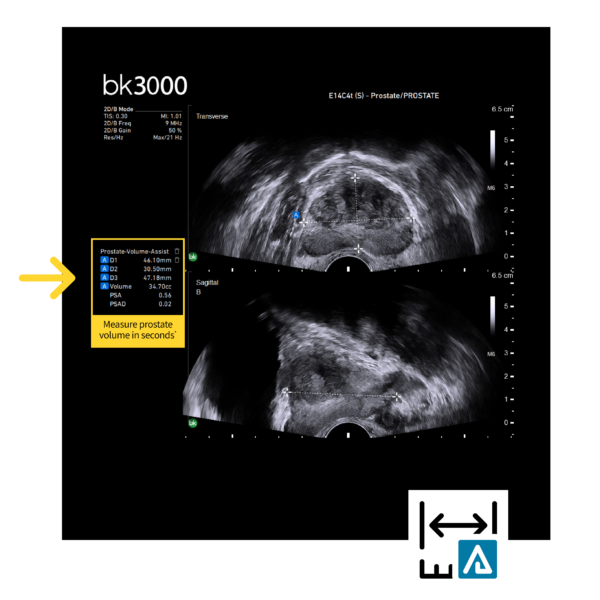 Ultrasound Machines for Prostate Imaging | BK Medical